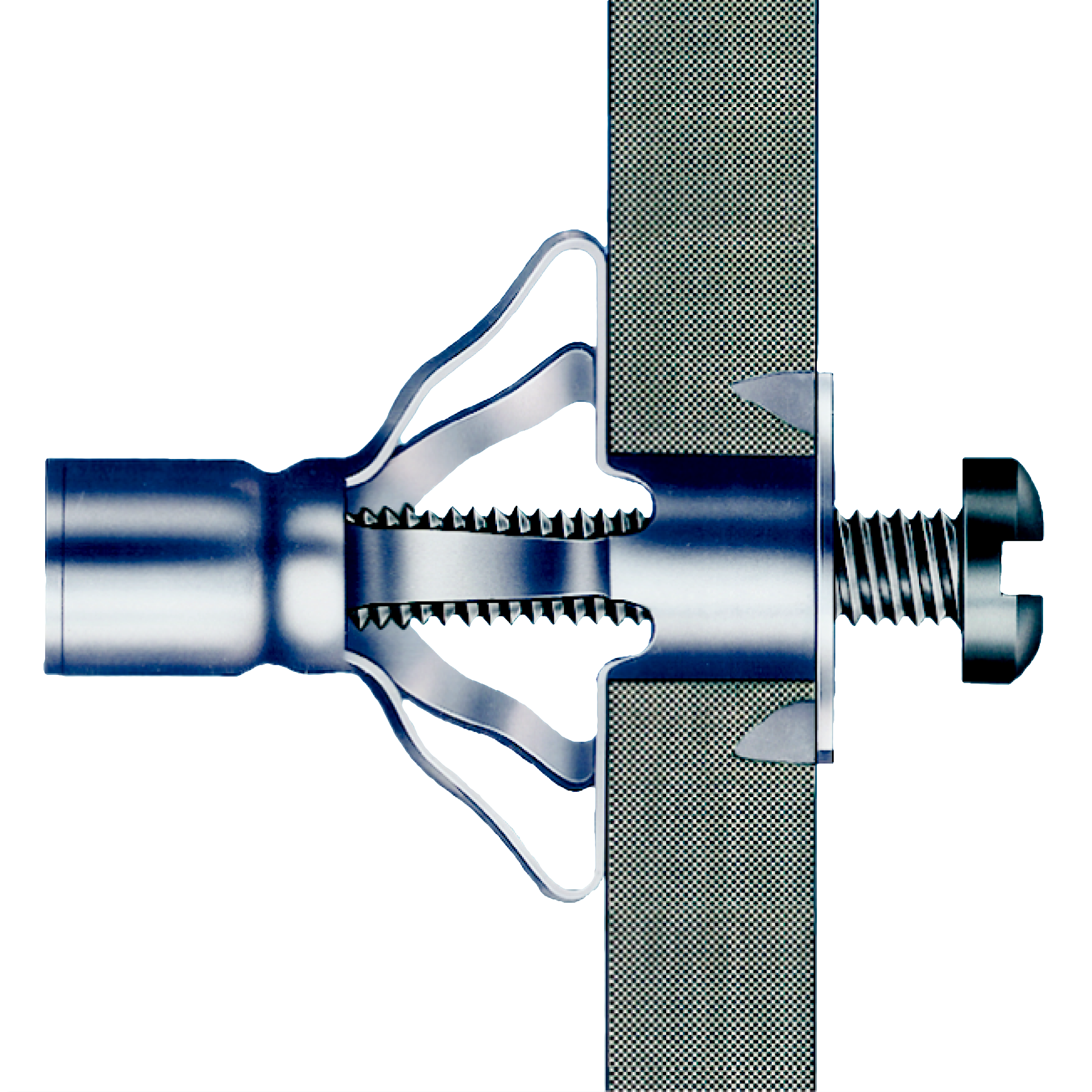 MÜPRO | Cavity plugs